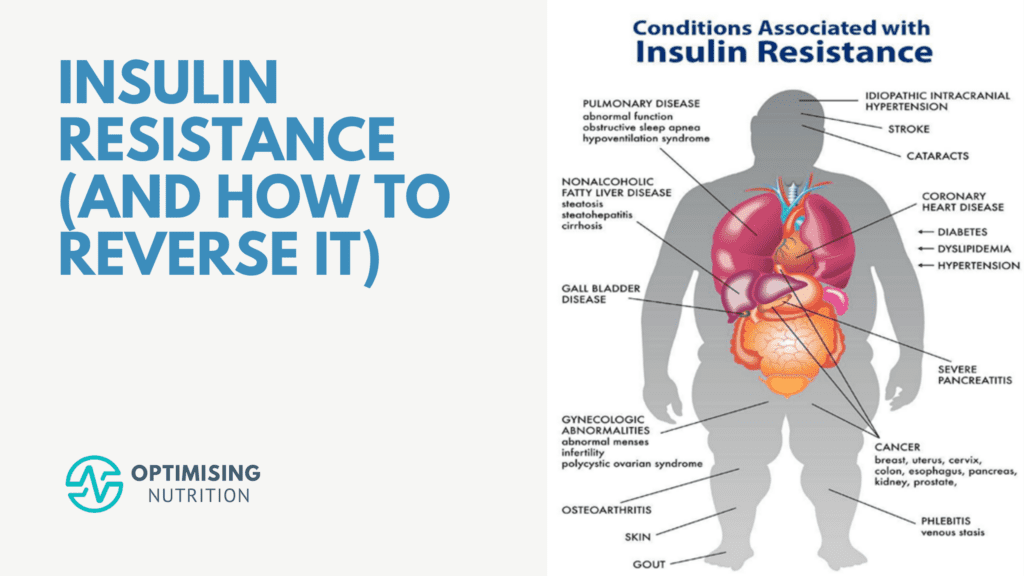 Master Macros for Insulin Resistance for Optimal Health | Optimising Nutrition